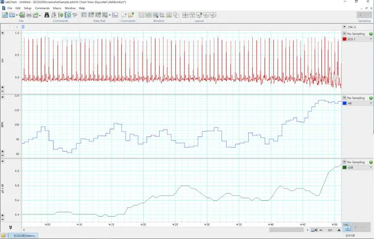 Biopotentials and GSR | ADInstruments